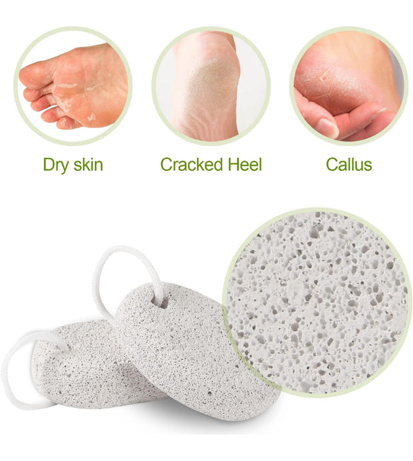 Pumice Stone for Calluses - PSquare Scents LLC